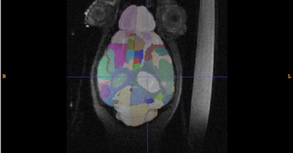 Female-led Team Investigates Increased Alzheimer’s Risk in Women | The ...