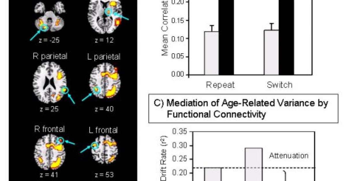 Task Related Functional Connectivity The Brain Imaging And Analysis