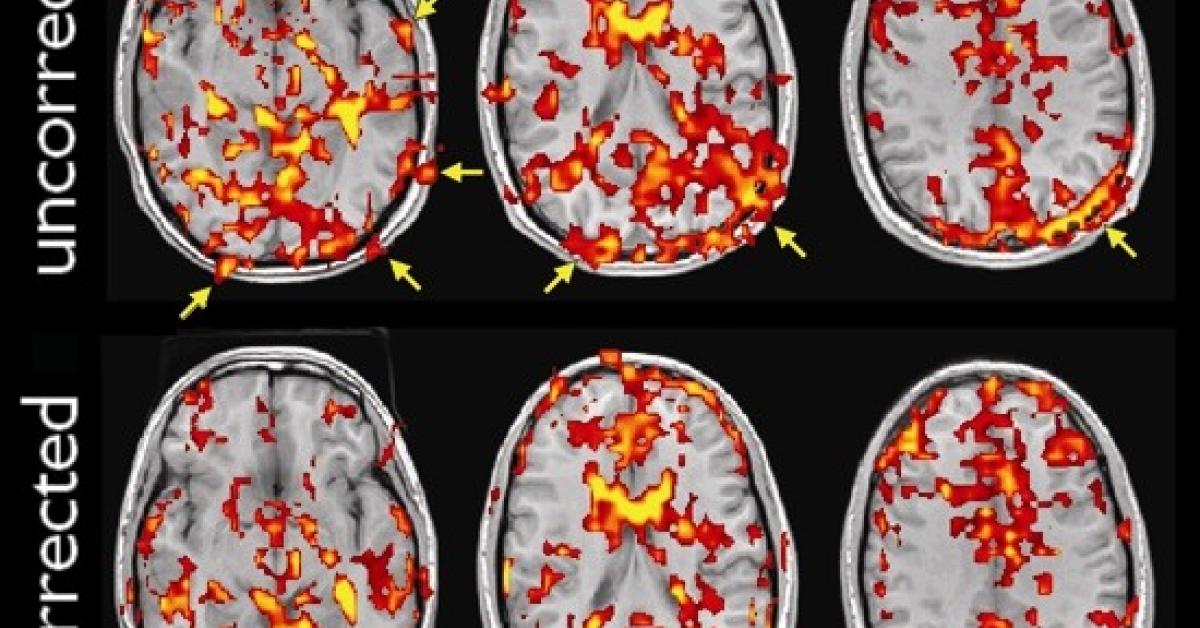 Inherent and Dynamic Deblurring for Spiral Imaging | The Brain Imaging ...