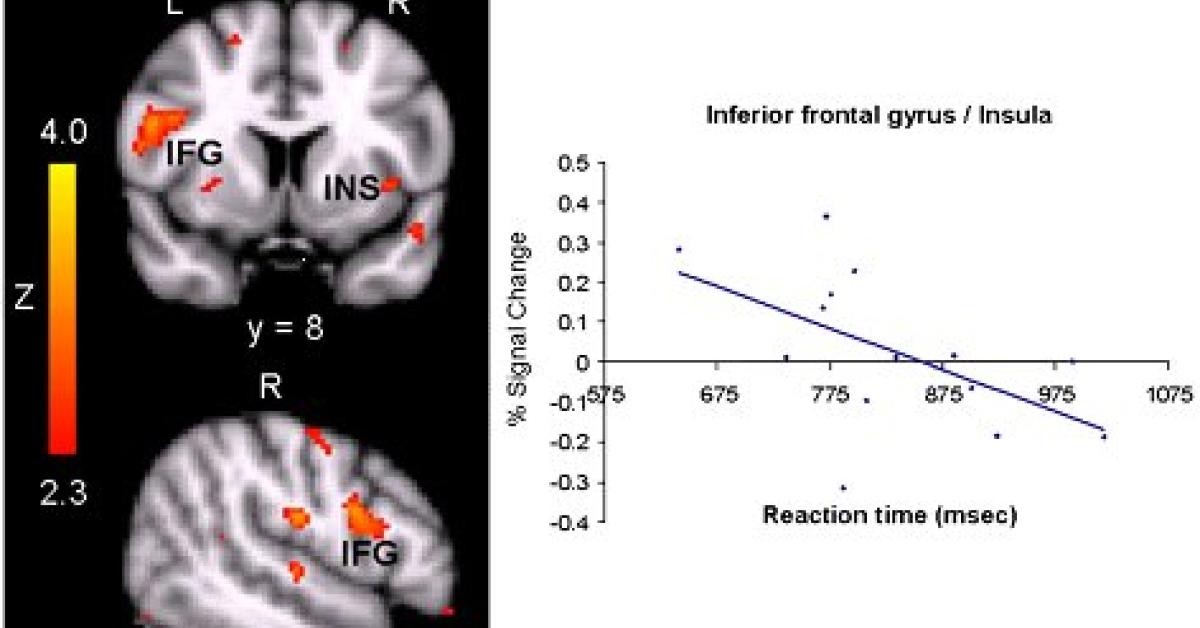 Emotional Priming Effects on Executive Function | The Brain Imaging and ...