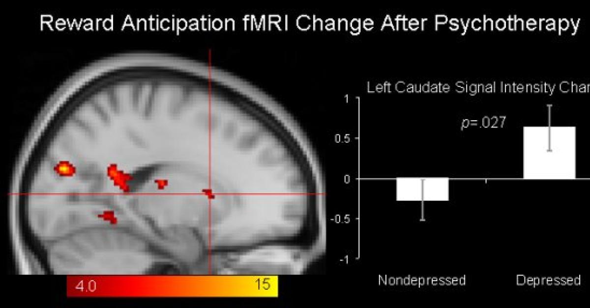 Effects on Brain Function of Psychotherapy for Depression | The Brain ...