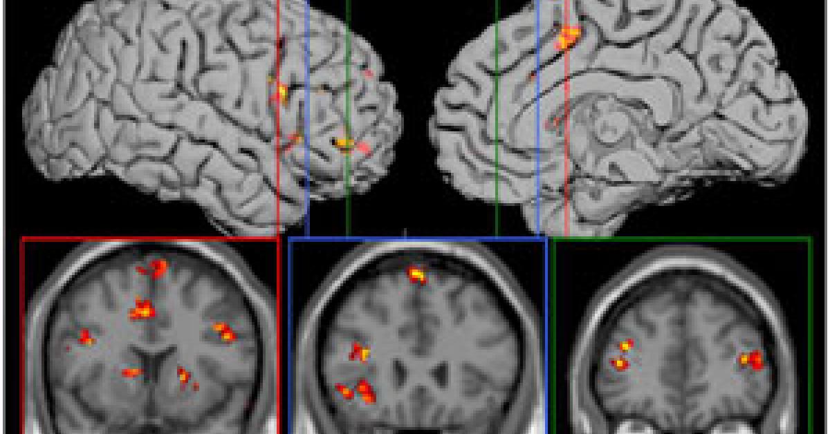 Pattern Recognition | The Brain Imaging and Analysis Center